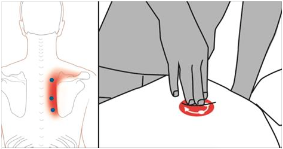 Shoulder / ПЛЕЧИ: TRIGGERPOINT THERAPY - TREATING THE RHOMBOIDS