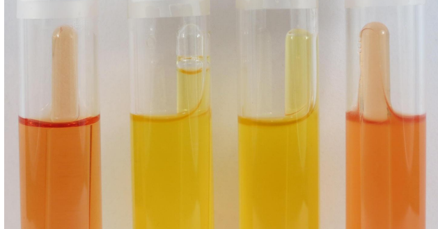 Ram Micro Arena : carbohydrate fermentation test