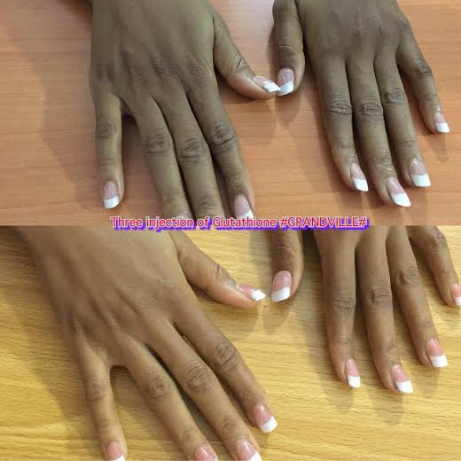 Shed off excess fat and get the best shade ofs kin colour without any ...