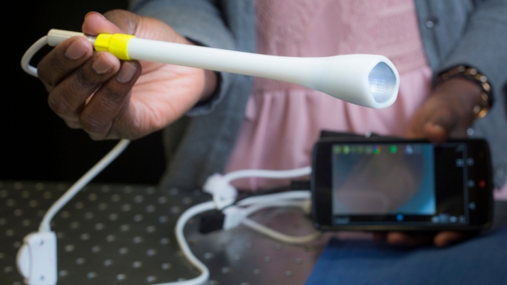 Ob/Gyn Updated : New slender hand-held pocket colposcope will make ...