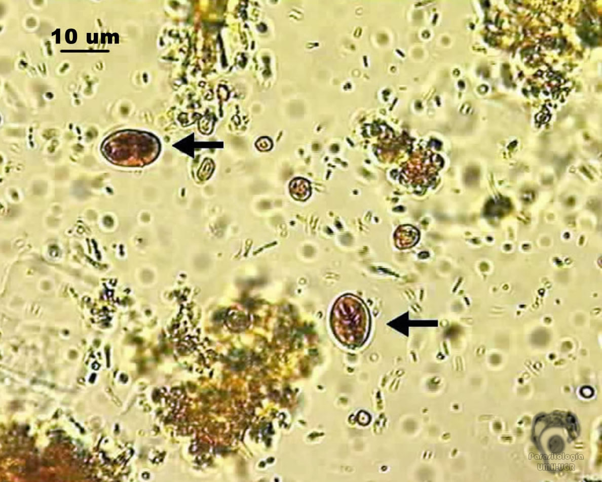 Giardia Lamblia: Morfología