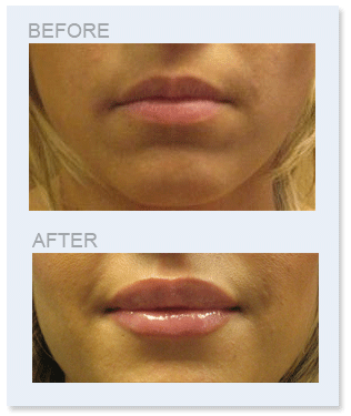 All Cosmetic Options : Your Guide to all cosmetic and beauty treatments ...