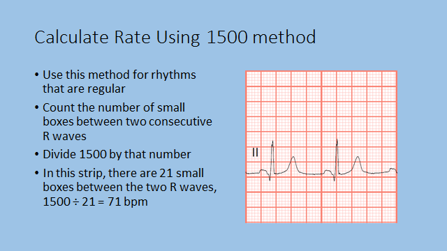 How To Calculate Heart Rate From Graph Haiper how-to-calculate-heart-rate-from-graph-haiper