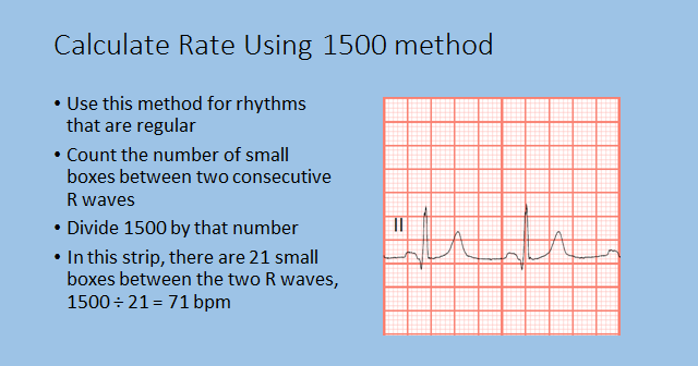 Telemetry Technician Course: Heart Rate Calculation Practice (class 4)