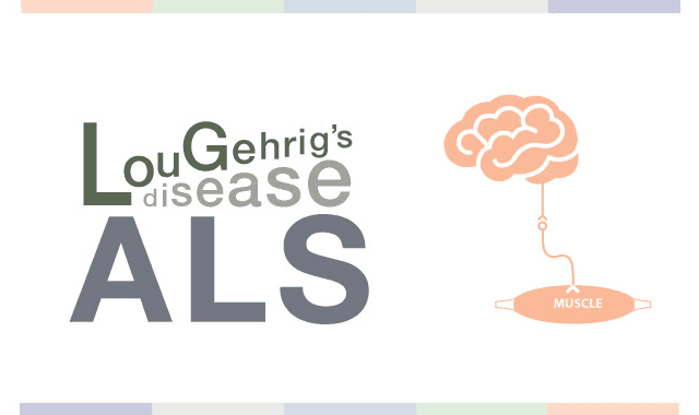 ALS (Amyotrophic Lateral Sclerosis) #infographic - Visualistan