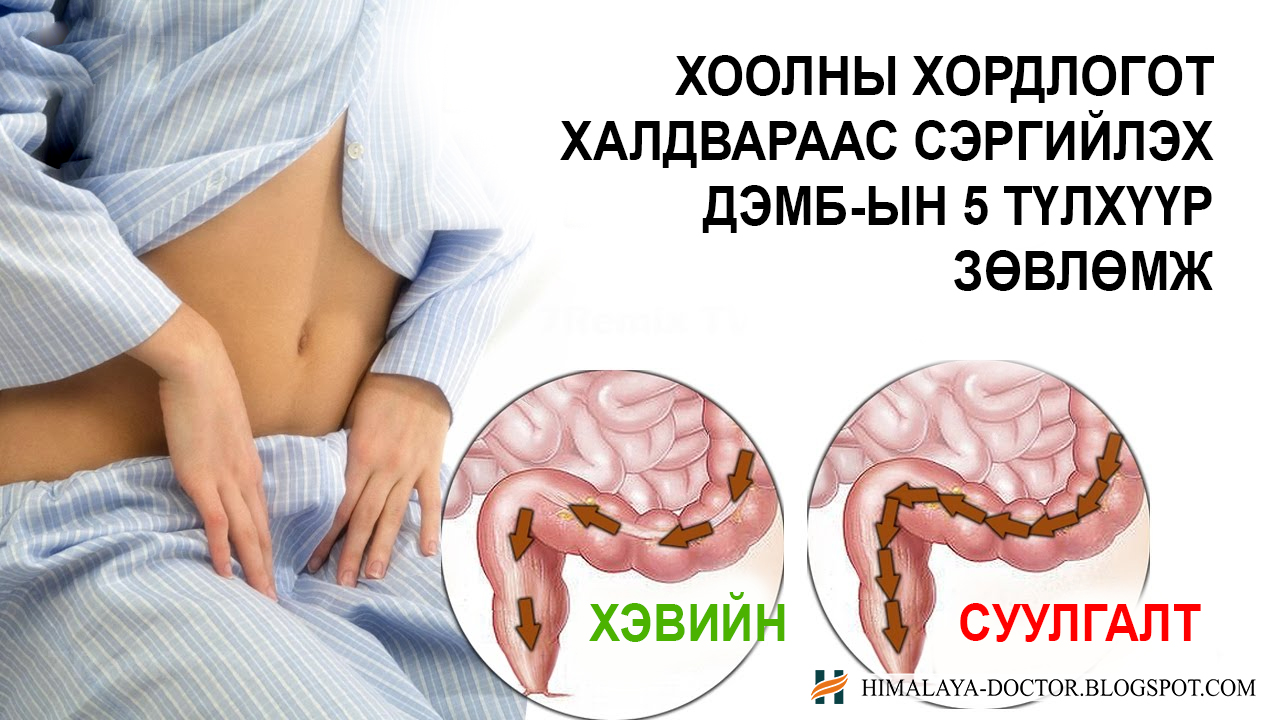 Хоолны хордлогот халдвараас сэргийлэх ДЭМБ ийн 5 түлхүүр зөвлөмж