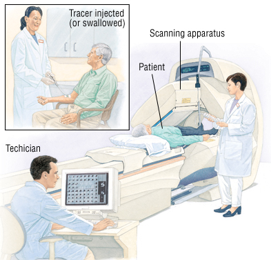 10,000 Strong Against Thyroid Cancer: Diagnosing Thyroid Cancer ...