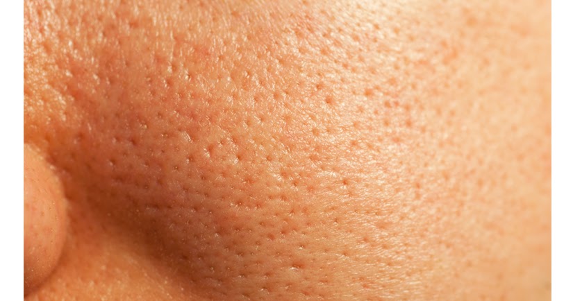 What are pores and why do we have them?