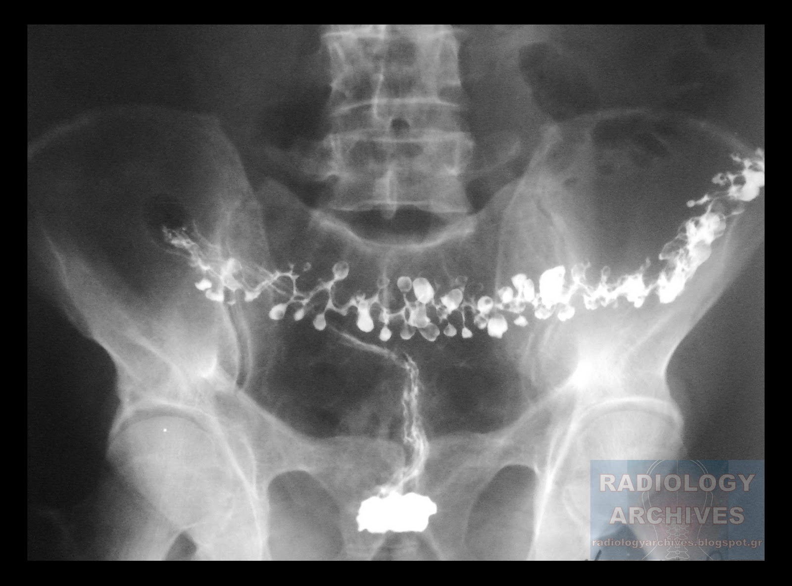 Radiology Archives: Ιουλίου 2012