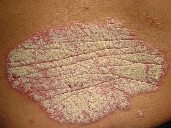 PMF Víctor Orduña: LESIONES ELEMENTALES