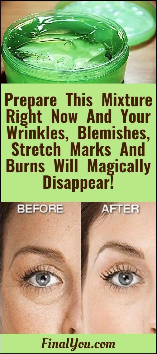 Prepare This Mixture Right Now And Your Wrinkles, Blemishes, Stretch ...