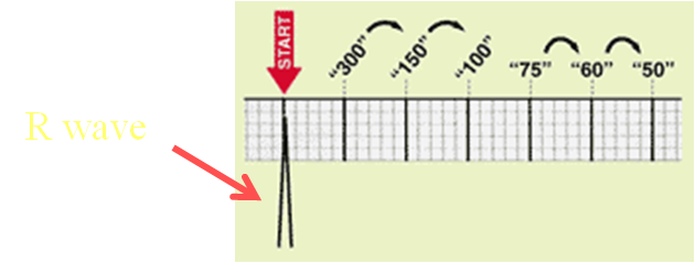 ECG Rhythm Interpretation-How to Analyze a Rhythm ~ Dentistry and Medicine