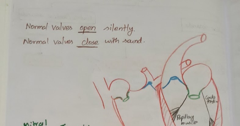 MEDGOAL: NORMAL HEART SOUNDS