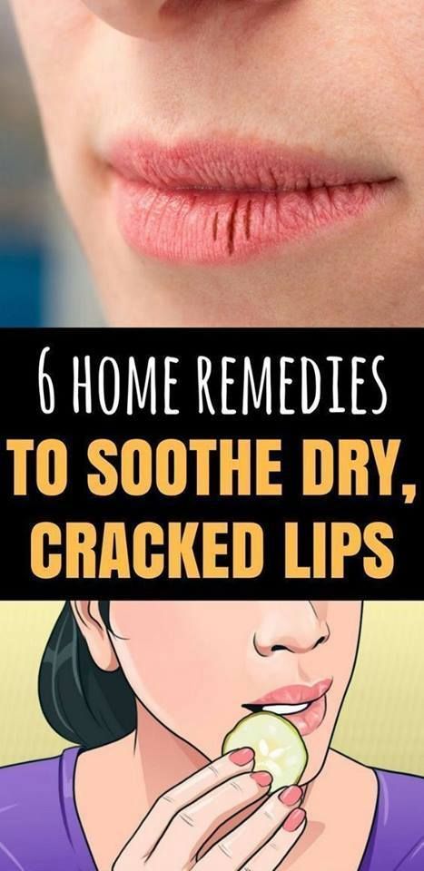6 Home Remedies To Soothe Dry & Cracked Lips - Fitness Fiesta