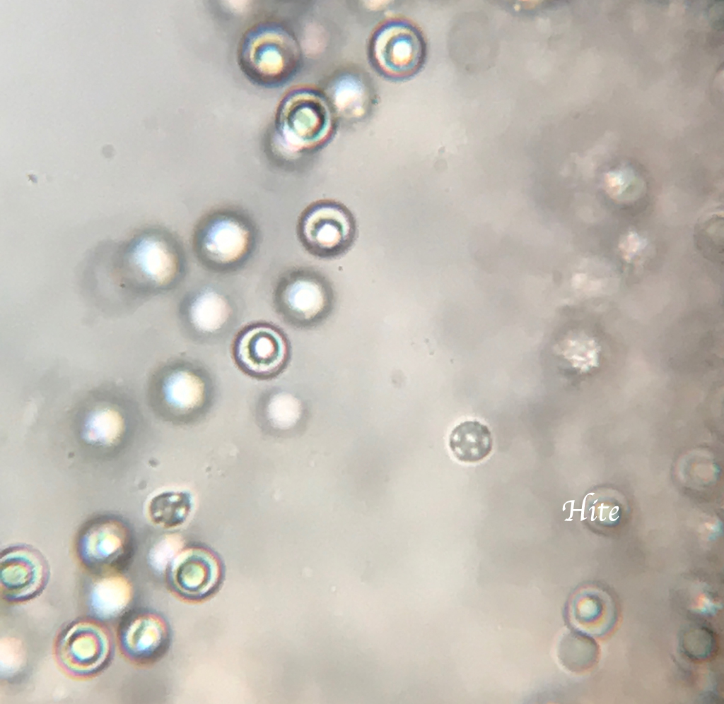 Hite's fish world: Dermocystidium