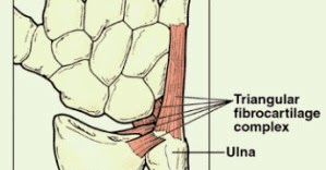 TFCC (Triangular Fibrocartilage complex) tear: Triangular ...