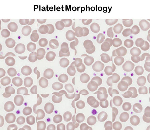 VETERINARY HEMATOLOGY DEXTERVET: Platelet morphology