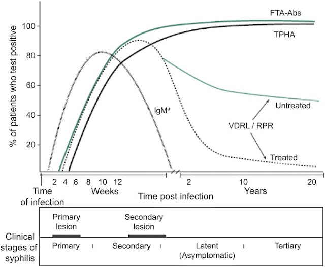 235 - Diagnosi e trattamento della sifilide