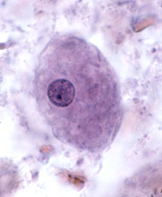 SOLO SE QUE NADA SE - MICROBIOLOGIA UNT: ENTAMOEBA COLI