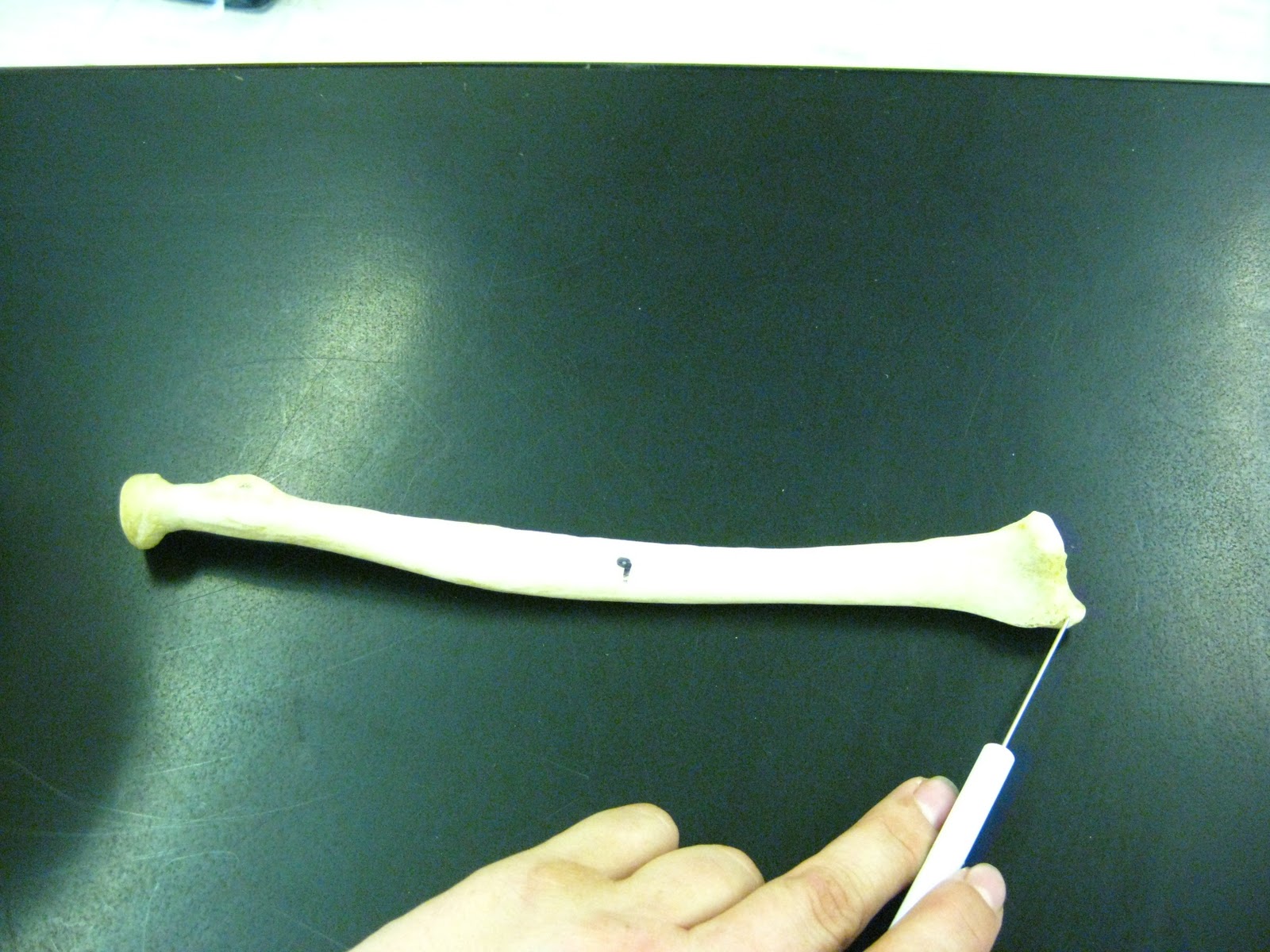 Boned: Human Skeleton - radius