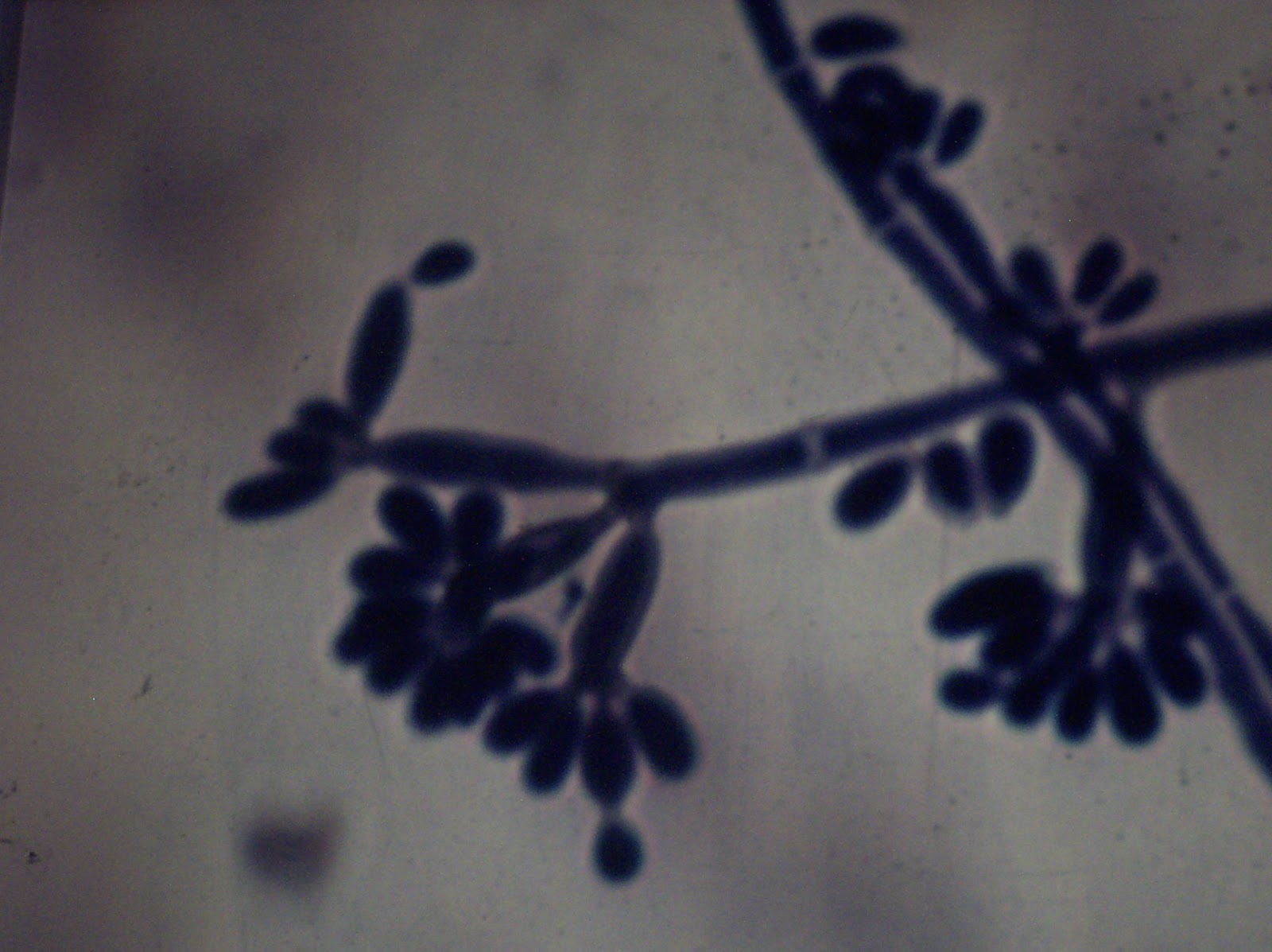 Lecture Notes in Medical Technology: Lecture #16: INTRODUCTION TO MYCOLOGY