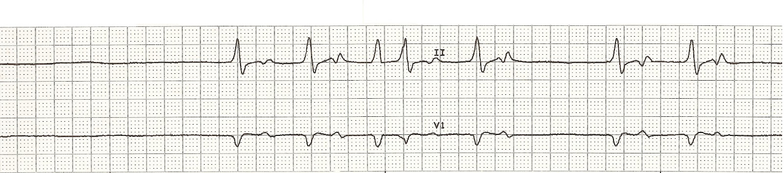 For in that sleep of death what dreams may come...