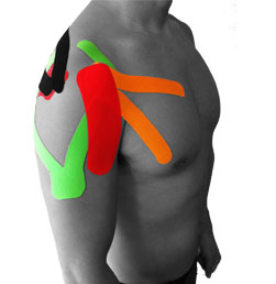 ARES Kinesiology Tape: Frozen Shoulder