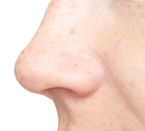 Is 1 Liter of Nasal Fluid Produced a Day Truly Normal? | Fauquier ENT Blog