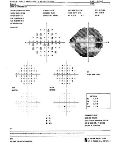 neurociencias: Escotomas: Conclusión Visual