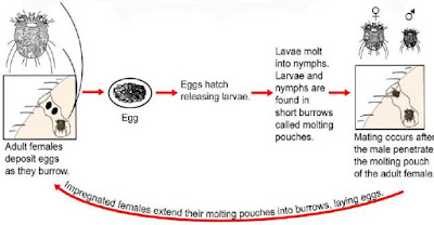 Asuhan Keperawatan Pasien Scabies Lengkap - askep