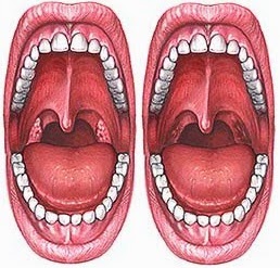 Medical Treatment Pictures-for Better Understanding: Tonsils Removal ...