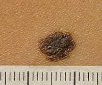 SEMIOLOGíA QUIRURGICA: EXPLORACION DE LA CABEZA