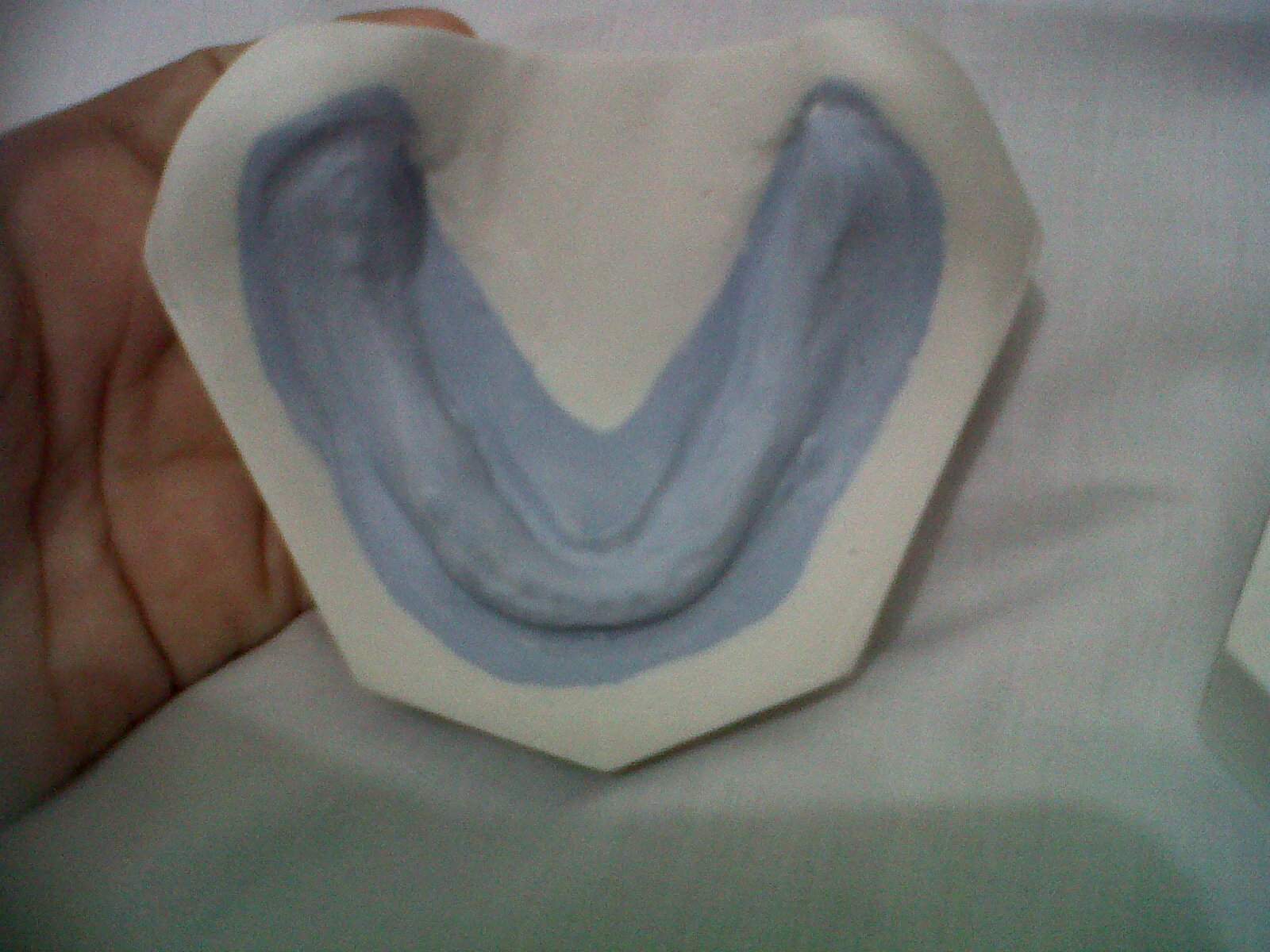 Praktikum Prosto 3 (Gigi Tiruan Lengkap)