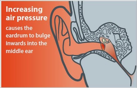 How to Avoid Ear Pain when Flying