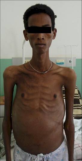 DescubreSemiologiaQuirurgicautesa: Torax Y Abdomen