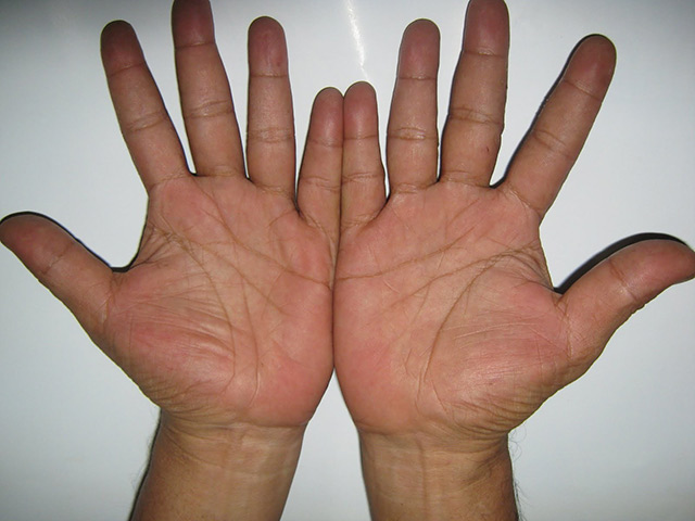 Coba Gabungkan Kedua Telapak Tangan Anda, Jika Ada Tanda Seperti Pada ...
