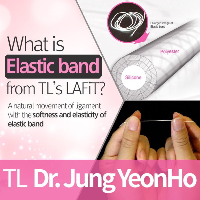 TLlifting_Singapore: elasticum lifting, LAFIT