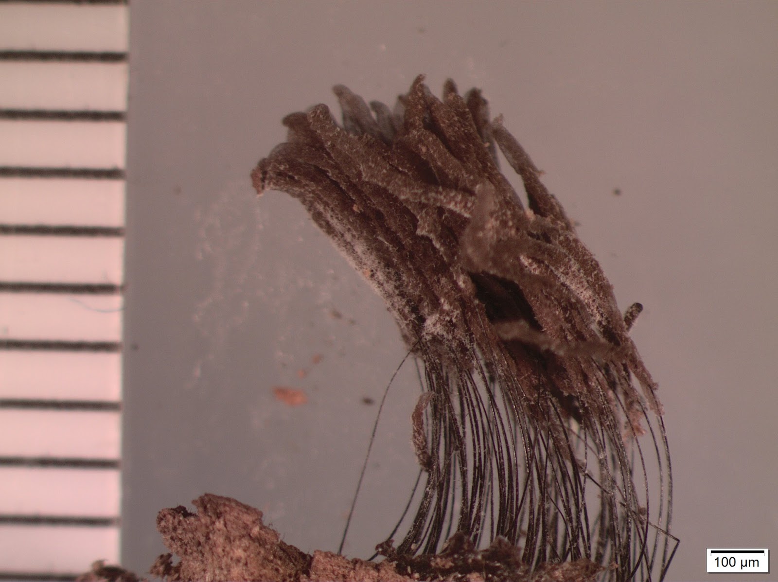 Welcome to the big world of tiny organisms: Specimen #18: Stemonitis