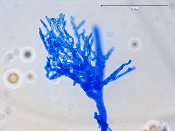 Fun With Microbiology (What's Buggin' You?): Apophysomyces elegans ...