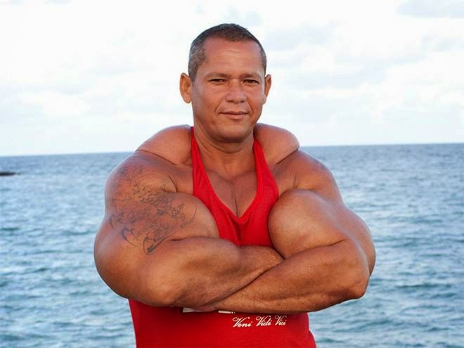 Synthol Freaks of the World | Bodybuilding and Fitness Zone