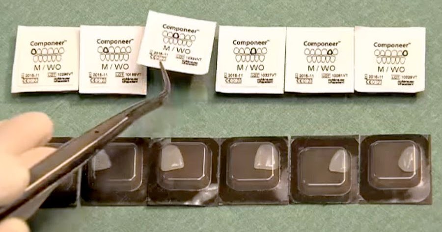 COMPONEER Direct Composite Veneering System - Odonto-Tv