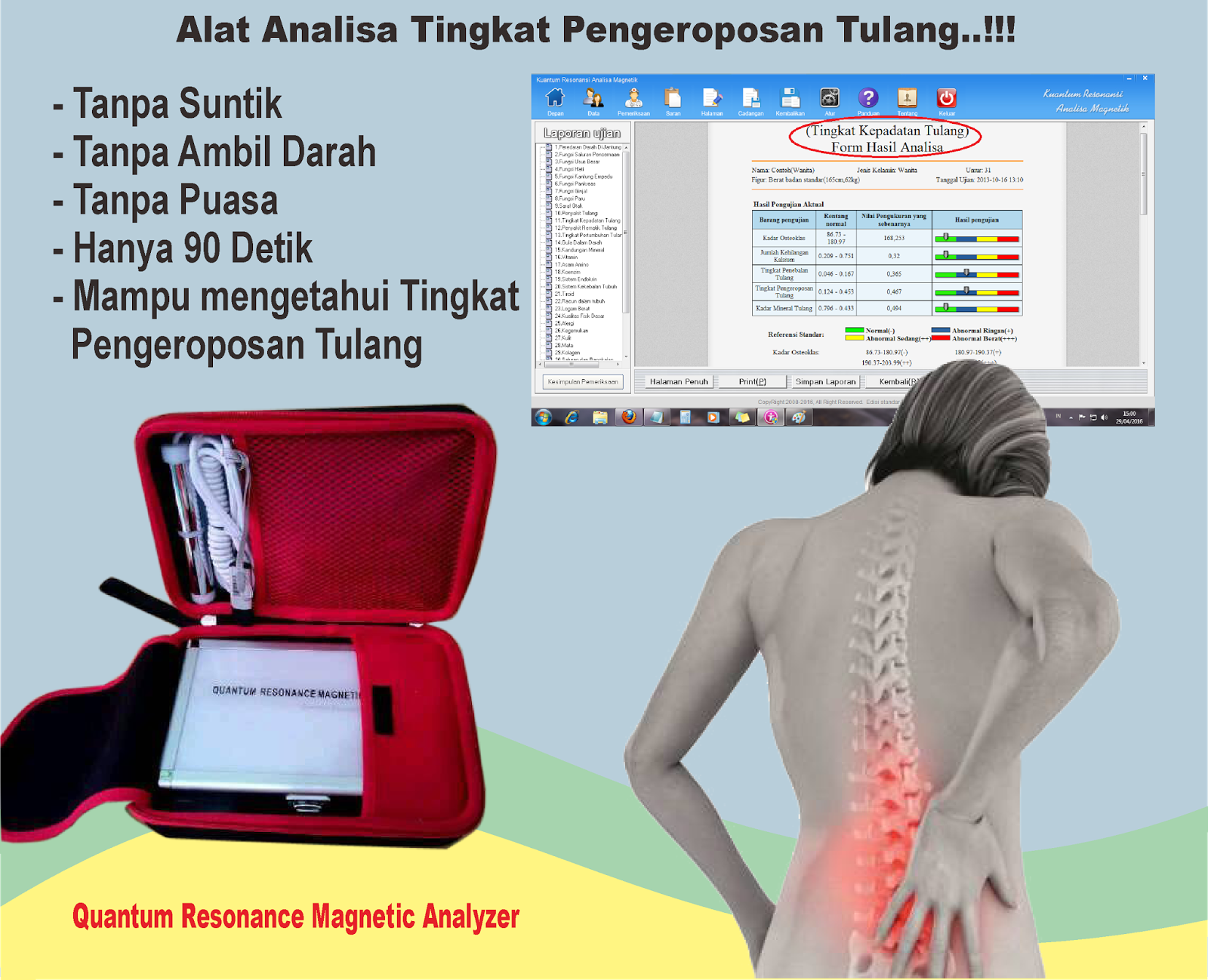TIPS MENGETAHUI TINGKAT KEPADATAN TULANG DENGAN CEPAT DAN MUDAH ~ INFO ...