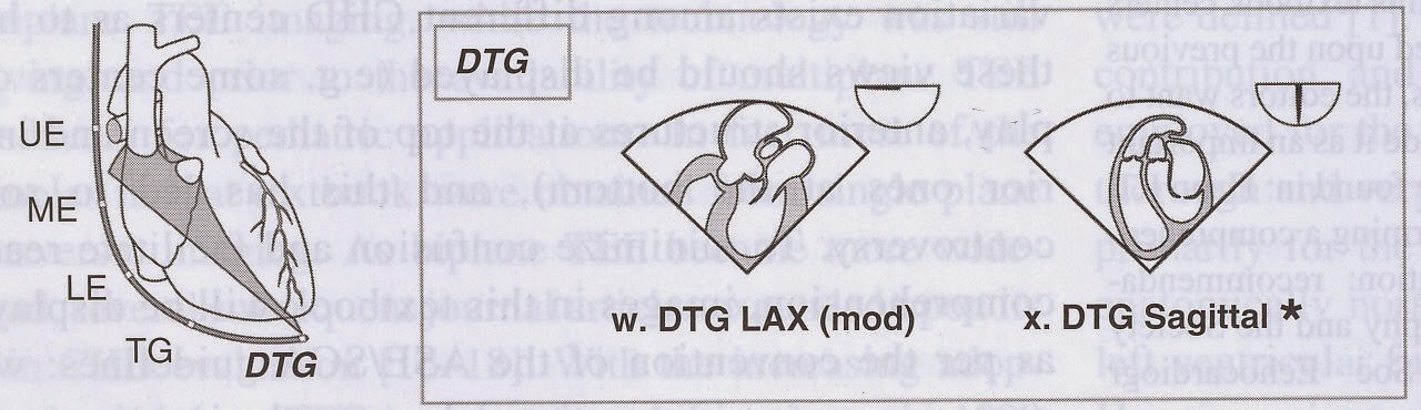 Pedi cardiology: TEE - Basic Views & terminology