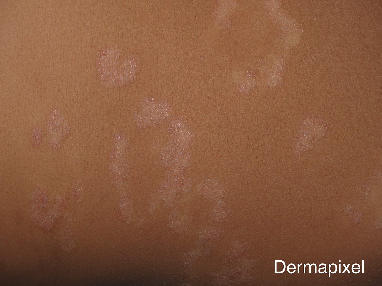 Dermapixel: julio 2018