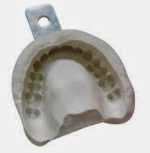 Alginate Impression material