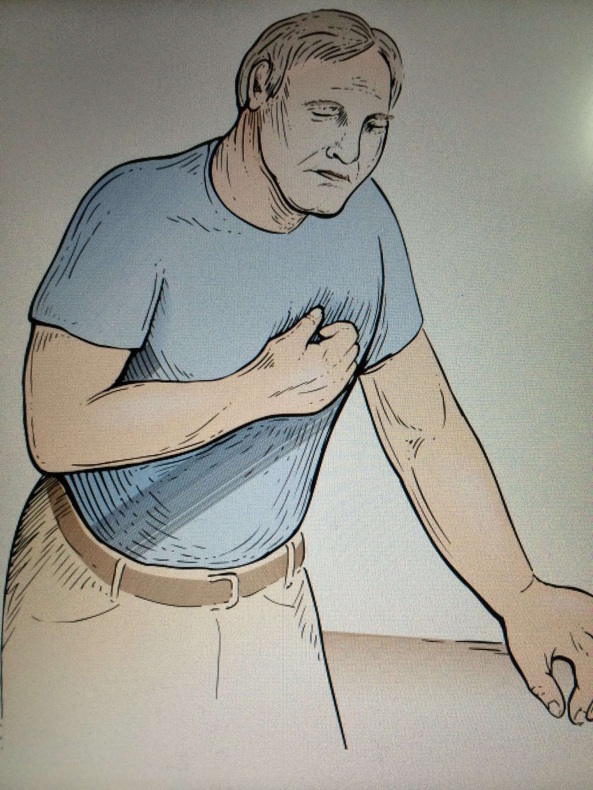 Liga de Cardiologia da UNICAMP: Quais são os sintomas que levam uma ...