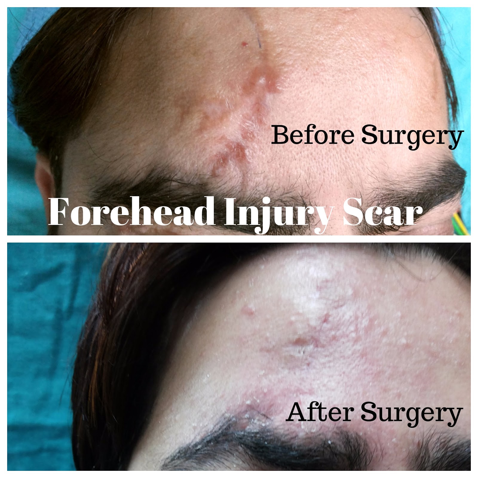 South Delhi Cosmetic Clinic- Best Cosmetic surgery Clinic in Delhi: How ...