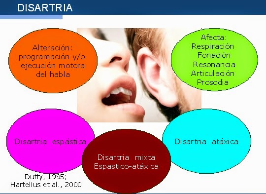 Disartria
