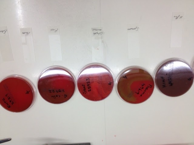 Meet the Microbes: Gram Staining - Why and How?