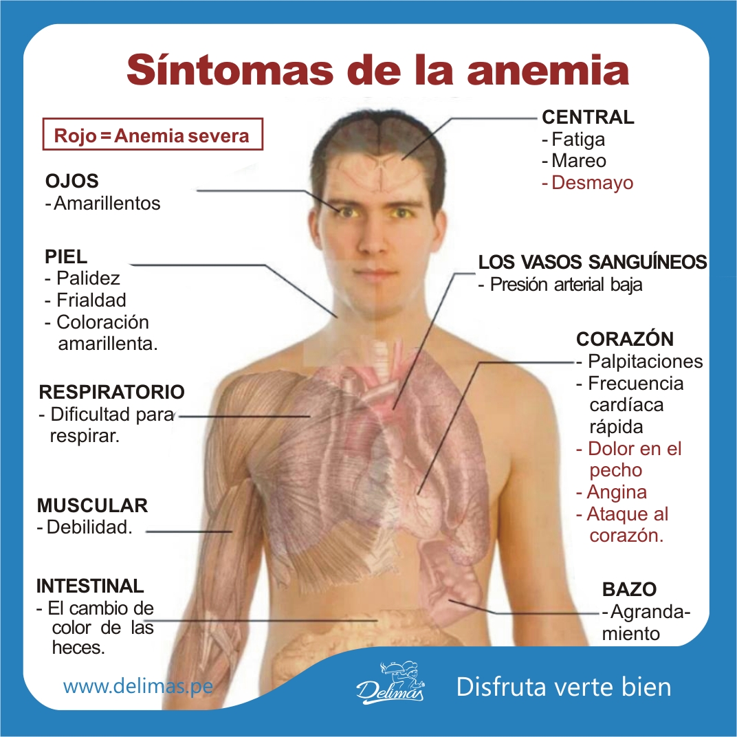 Creando Hábitos Saludables: COMO PREVENIR LA ANEMIA